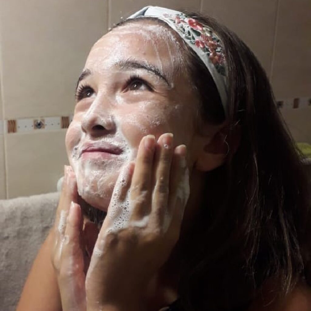 Vicky Tips: Combatiendo el Acné de Forma Natural | Vicky Green